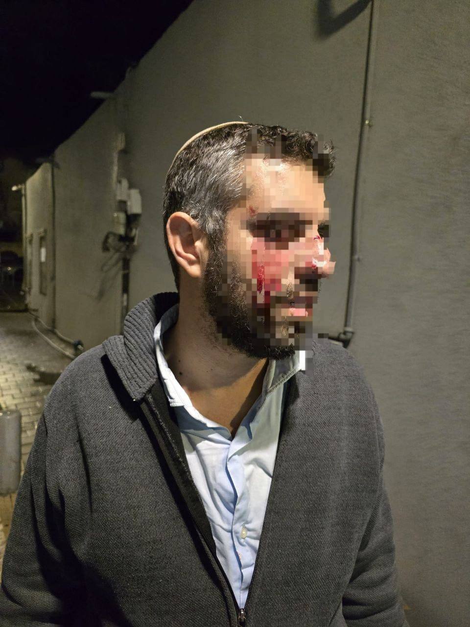 Gaza-Wounded IDF Reservist Rabbi Assaulted in Jaffa Street Attack ...